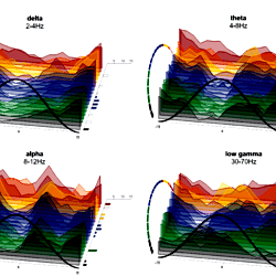 Waterfall plots show z-transformed amplitude modulation phase locked to ...