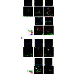 Intracellular GC and F-actin accumulation at adherent sites in ...