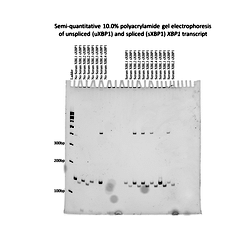 Unspliced, spliced, and total XBP1 semi-quantitative RT-PCR to identify ...
