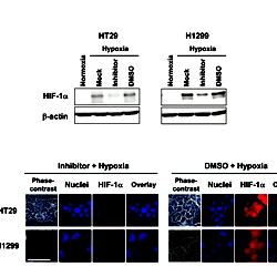 Figure S1 - The hTERT Promoter Enhances the Antitumor Activity of an ...