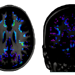 Figure S1 - White Matter Development in Early Puberty: A Longitudinal ...
