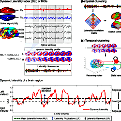 The workflow of dynamic laterality analysis.