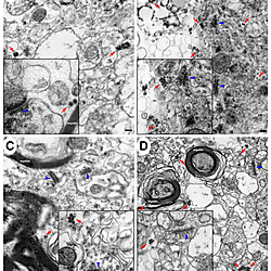 The localization of EEEV virions near synapses via transmission ...
