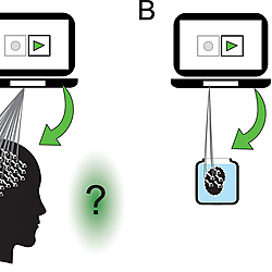 Step 3: Surgically removing brain tissue.