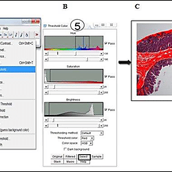 Deconvolution of colour images and identification of blue-stained ...