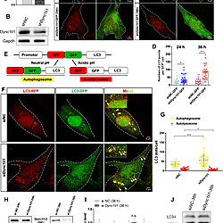 Accumulation of autophagosomes in Dync1li1 KD HEI-OC1 cells.