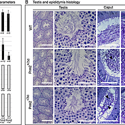 Sperm and testis parameters and histology.