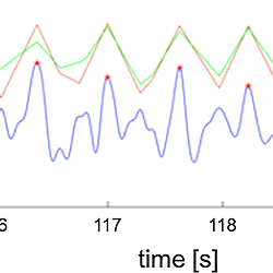 R-peaks estimation using CNN vs R-peaks from ECG signal.