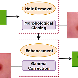 Steps performed for image pre-processing.