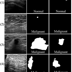 Illustration of segmentation failure examples.