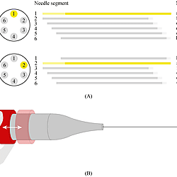 Visualisation of the motion sequence of the needle segments.