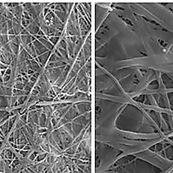 The scanning electron microscope (SEM) of MCF7 adhesion and spreading on polylactic acid ...