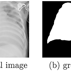 An example of CXR image and corresponding ground truth.
