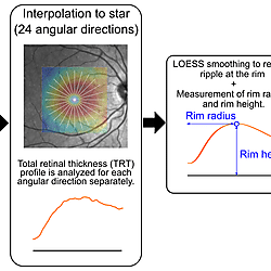 Foveal pit morphology analysis pipeline.