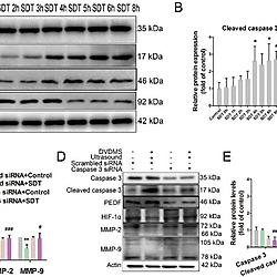 Sinoporphyrin sodium-mediated sonodynamic therapy (DVDMS-SDT) increases ...
