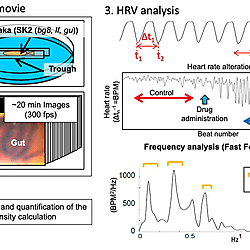 The method for extracting the heart movement.