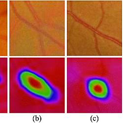 Visual explanation of prediction results.