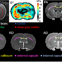 Typical images/maps obtained with this MRI protocol.
