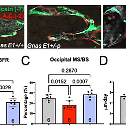 Dynamic mineral labeling histomorphometry of Gnas E1+/- and WT ...