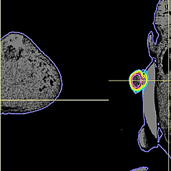 Isodose demonstration on micro-CT images in CERR.