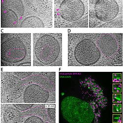 The stages of IV assembly.