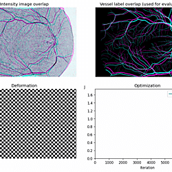 Illustrative animation of INSPIRE applied to a retinal image pair.