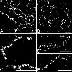 STORM super-resolution images of the Y loops.