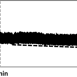 Plethysmogram representing the total monitoring time with EIT.
