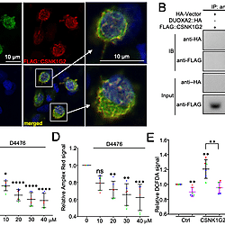Human CSNK1G2 interacts with DUOXA2 and promotes ROS levels.