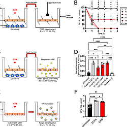 GXM decreases the trans-endothelial electrical resistance (TEER) and ...
