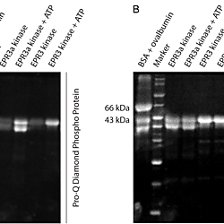 EPR3a and EPR3 contain catalytically active kinases.