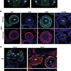 Six1 and Six2’s requirement for cranial-mesoderm-derived esophagus ...