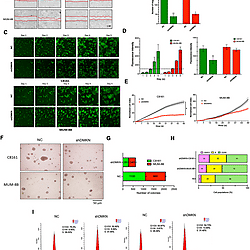 DMKN knockdown reduced cell migration in advanced melanoma cell lines.