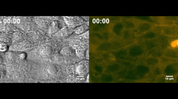 Time-lapse microscopy of cell undergoing extrusion as showcased by ...