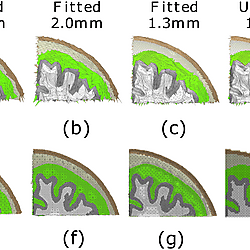 Mesh visualization: MRI-based model.