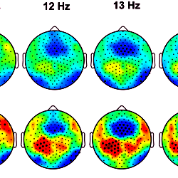Topography of the correlation of age with NREM EEG spectral density in ...