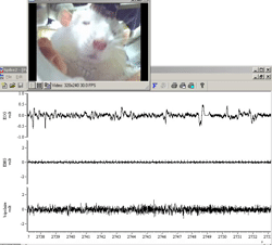 Localization of the Brainstem GABAergic Neurons Controlling Paradoxical ...