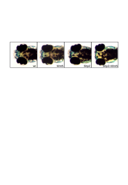 Shp2 Knockdown and Noonan/LEOPARD Mutant Shp2–Induced Gastrulation Defects