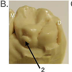 Anterior (incisor and canine) and posterior (molar) tooth traits scored.