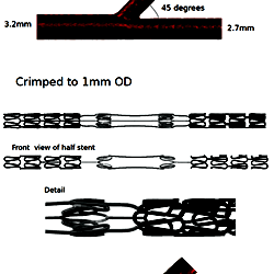 The creation of bifurcation model with side branch origin at 45 degrees ...