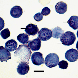 ATII cell identification.