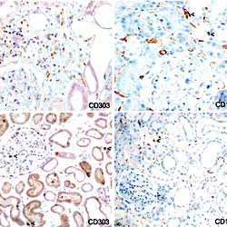 Localization of the DC subtypes in kidney cortex.