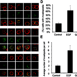Invadopodia formation assay and quantification analysis with confocal ...