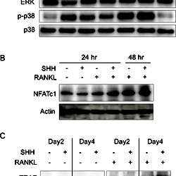 Effects of SHH on MAP kinase activity and osteoclast differentiation.
