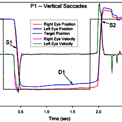 Representative record of vertical saccades made by P1.