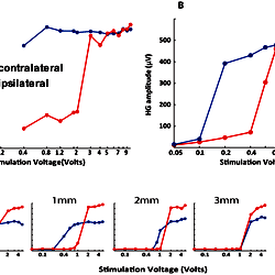 Ipsilateral Versus contralateral spinal cord stimulation.