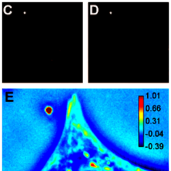 Quantitative phase imaging using real-time SLIM.