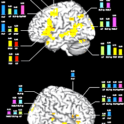 Schematic illustration of the language connectome.