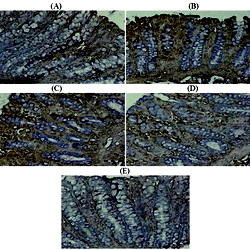 Photomicrographs depicting immunohistochemical staining of iNOS.