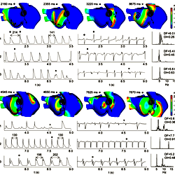AF episodes. Snapshots, APs, EGM and spectral analysis in selected spoints.